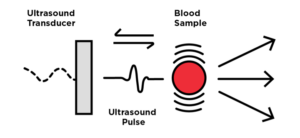 How the Quantra® System Works: Introducing SEER | HemoSonics